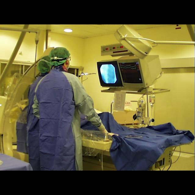 Rôle du manipulateur en radiologie interventionnelle - 9