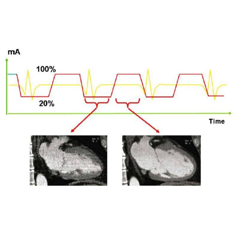 La tomodensitométrie cardiaque - 12
