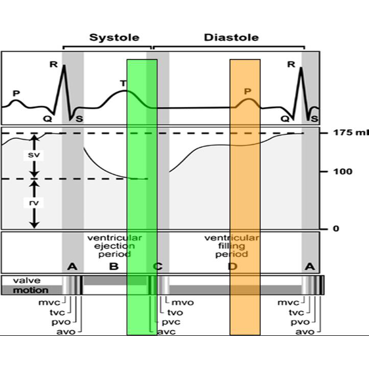 La tomodensitométrie cardiaque - 16