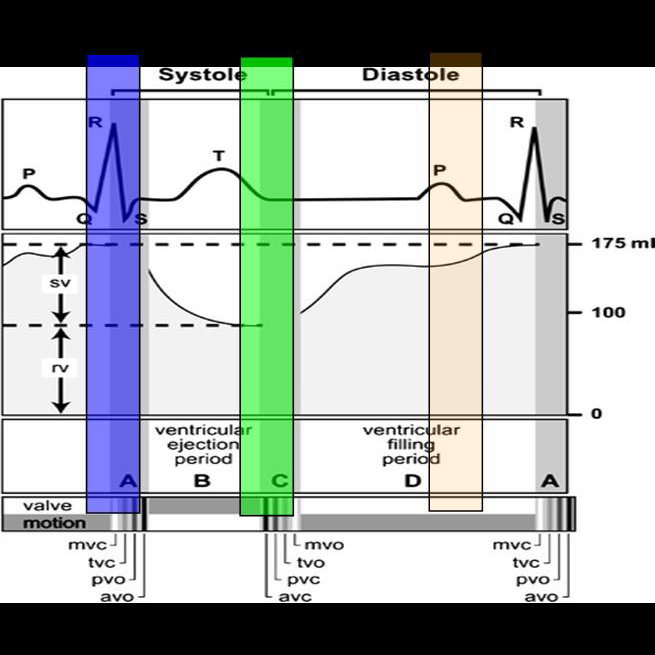 La tomodensitométrie cardiaque - 17