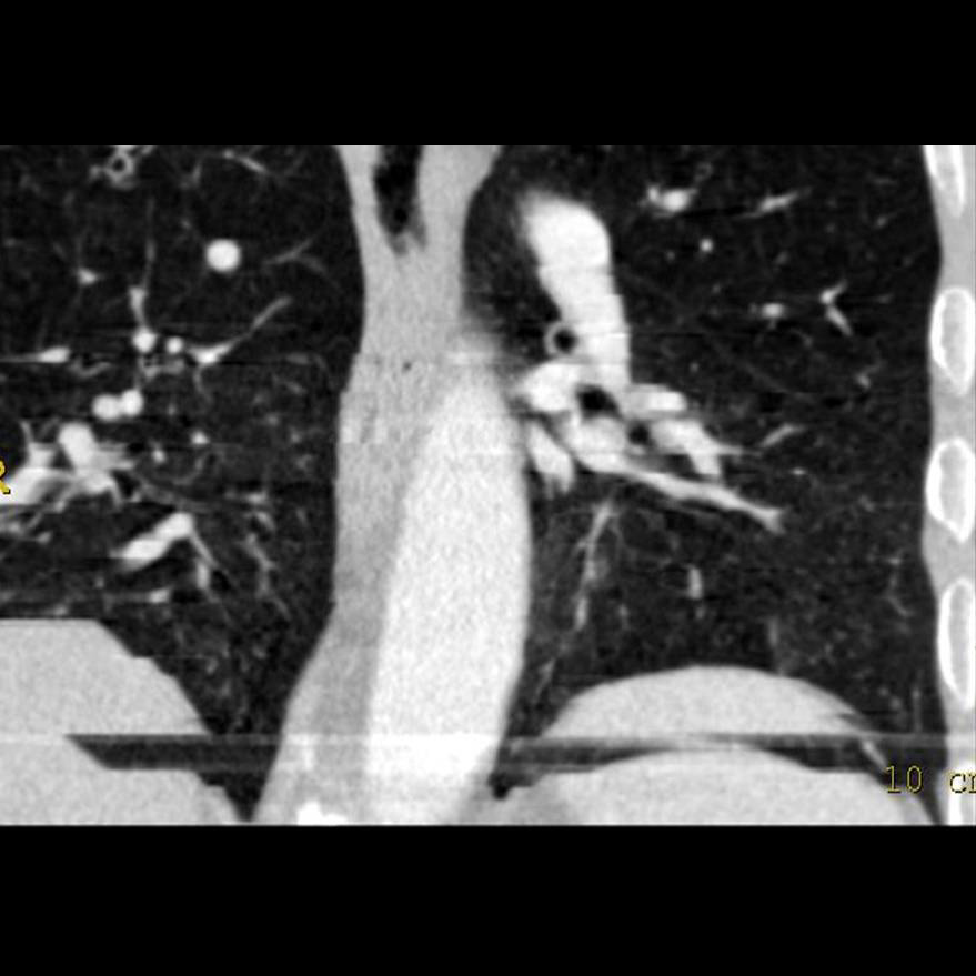 La tomodensitométrie cardiaque - 6