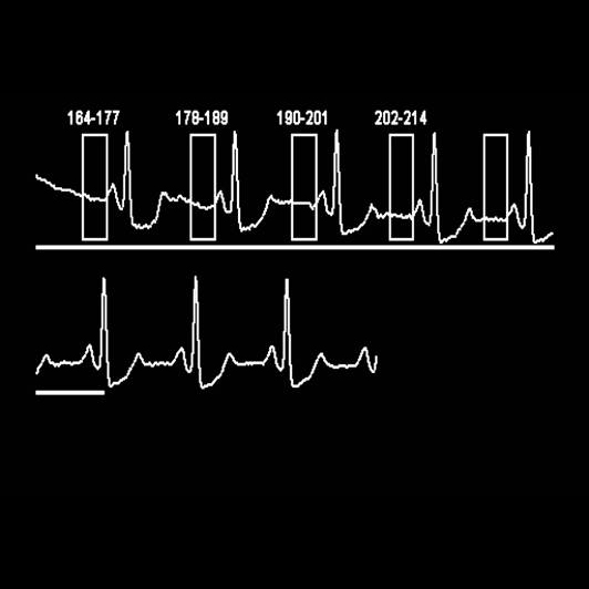 La tomodensitométrie cardiaque - 9